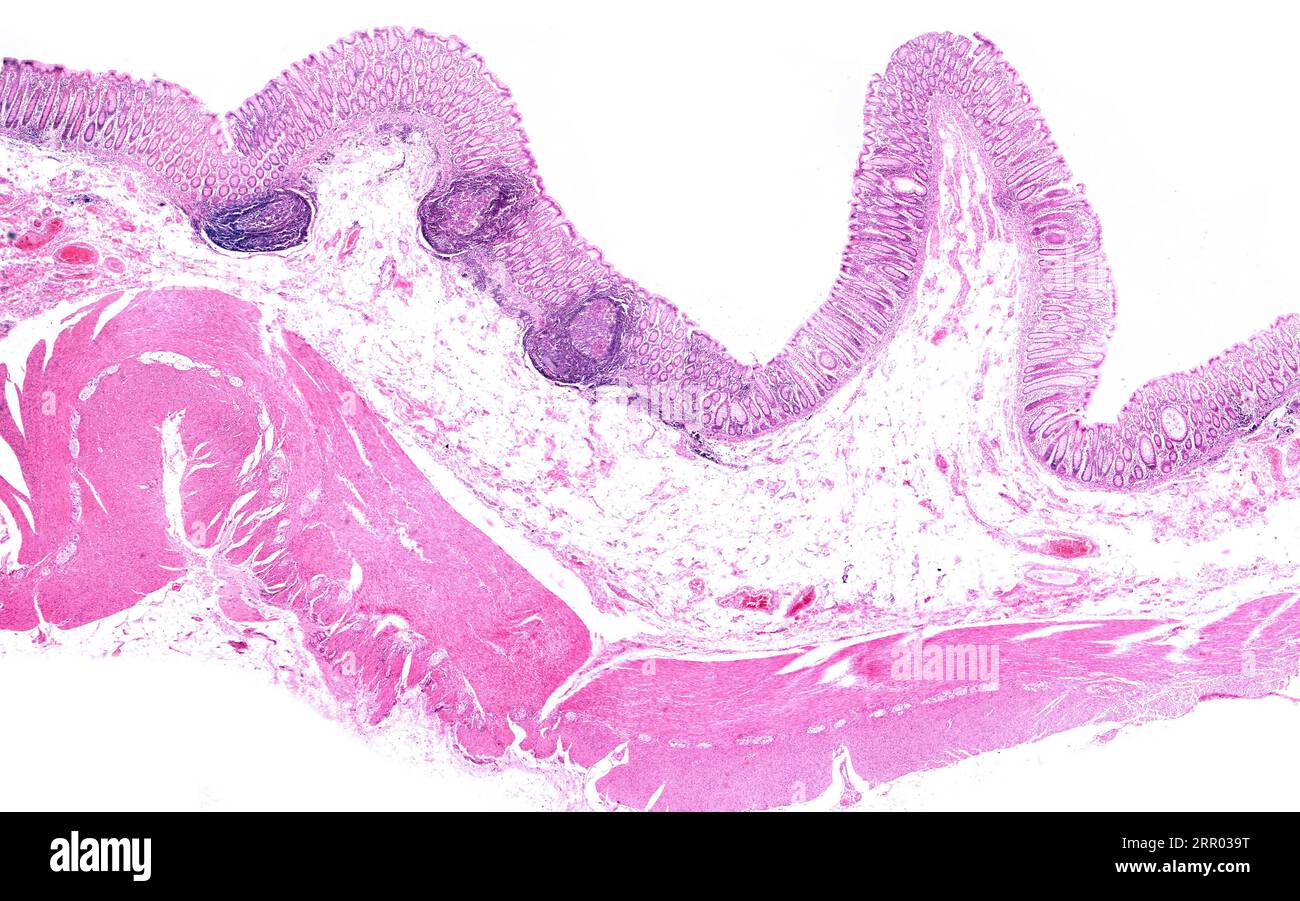 Human large intestine wall, light micrograph Stock Photo - Alamy