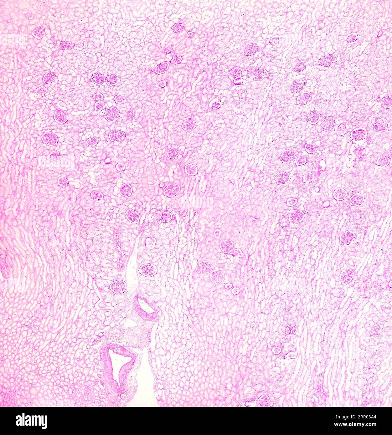 Human kidney, light micrograph Stock Photo - Alamy