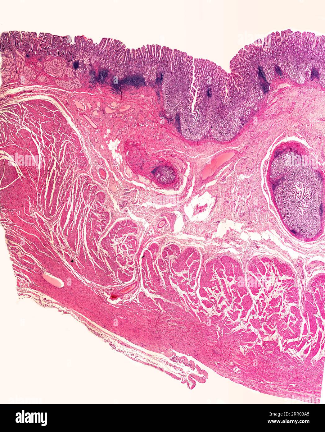 Human stomach pylorus, light micrograph Stock Photo - Alamy