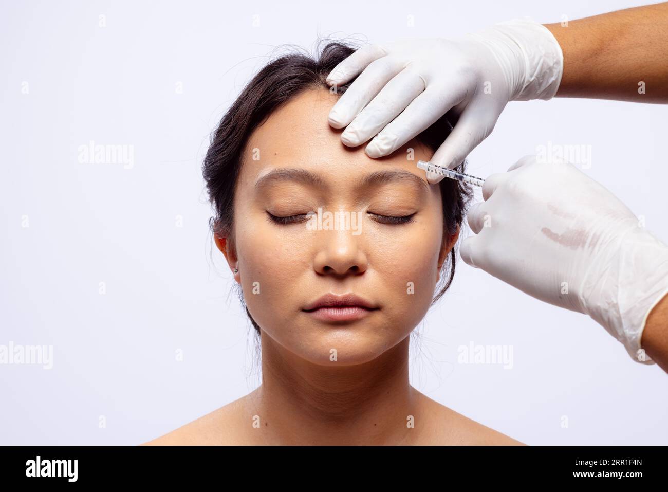 Hands of beautician in white surgical gloves injecting botox in brow of ...