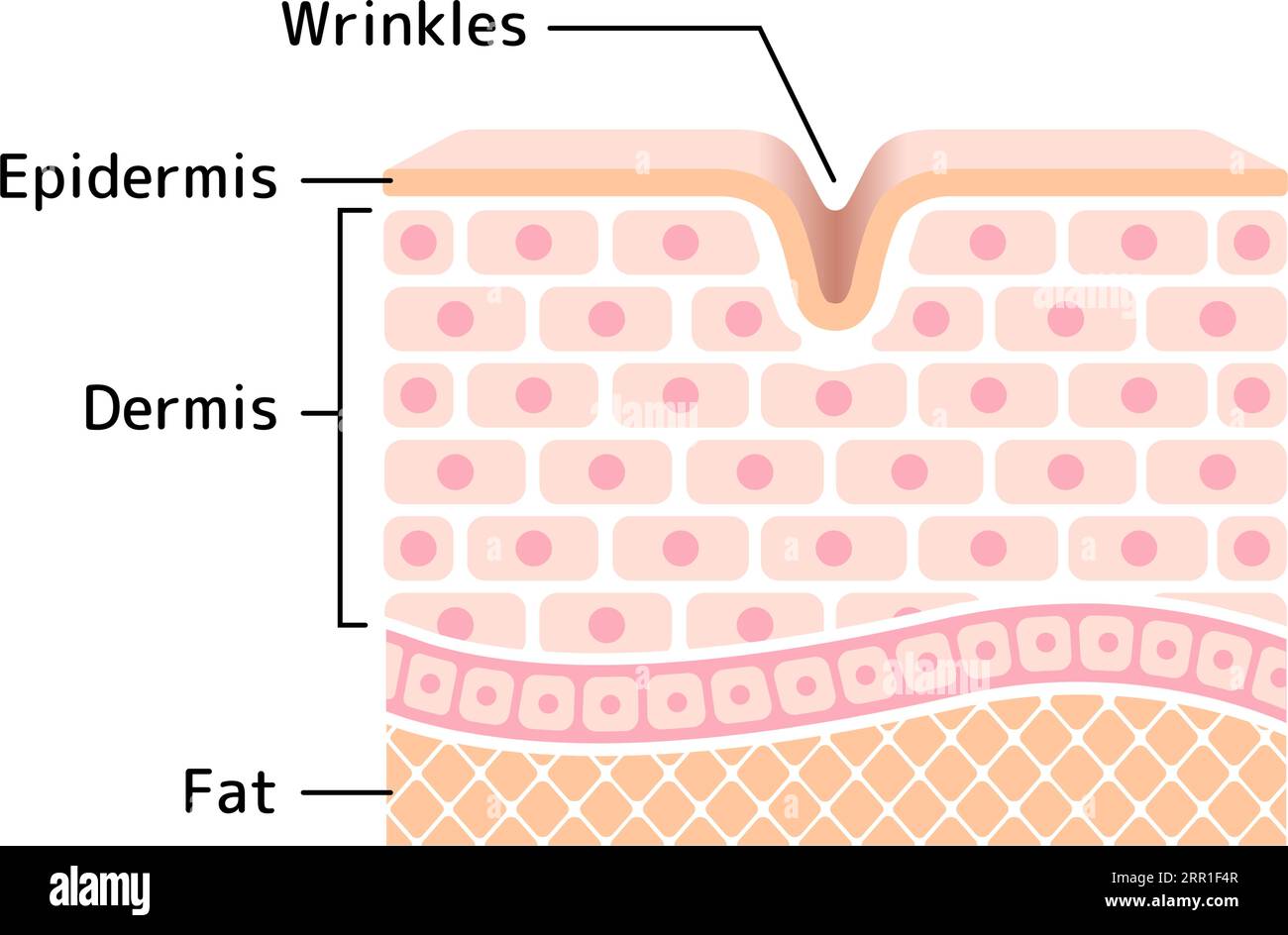 Cross section illustration of wrinkled skin Stock Vector Image & Art ...