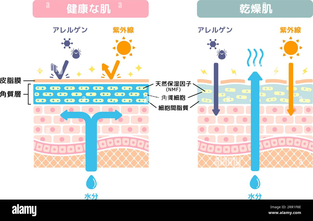 Comparison Illustration Of Healthy Skin And Dry Skin Cross Section Of