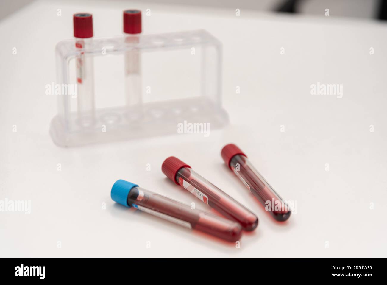 Set of test tubes with blood placed on white table in modern light ...
