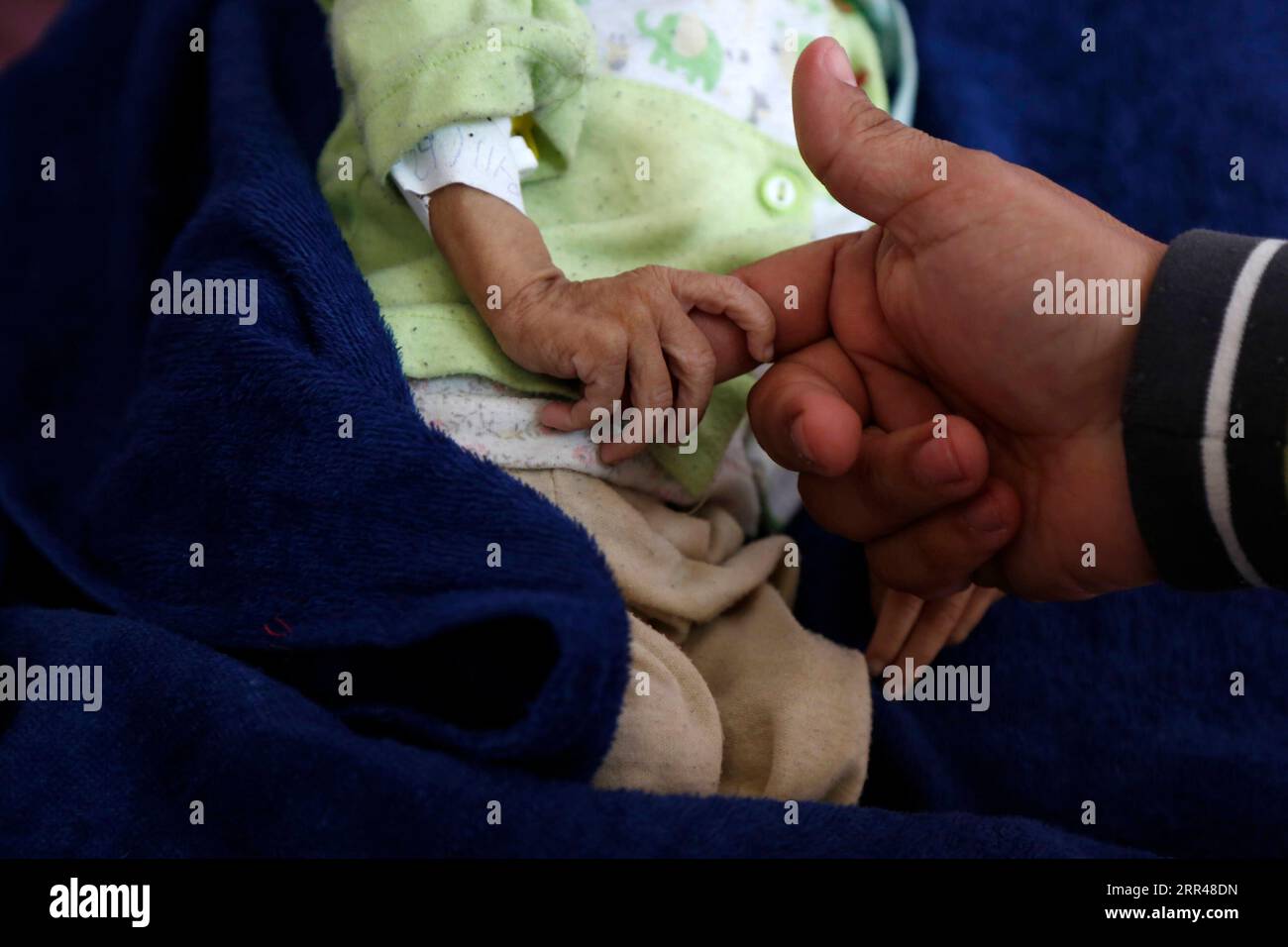 Yemen sana famine children hi-res stock photography and images - Alamy