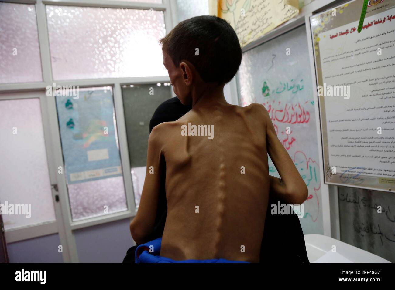 Yemen sana famine children hi-res stock photography and images - Alamy