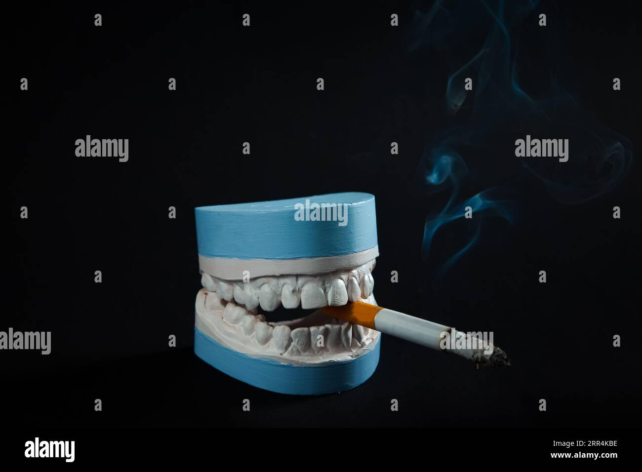 Plaster model of the jaw with a cigarette on a black background ...