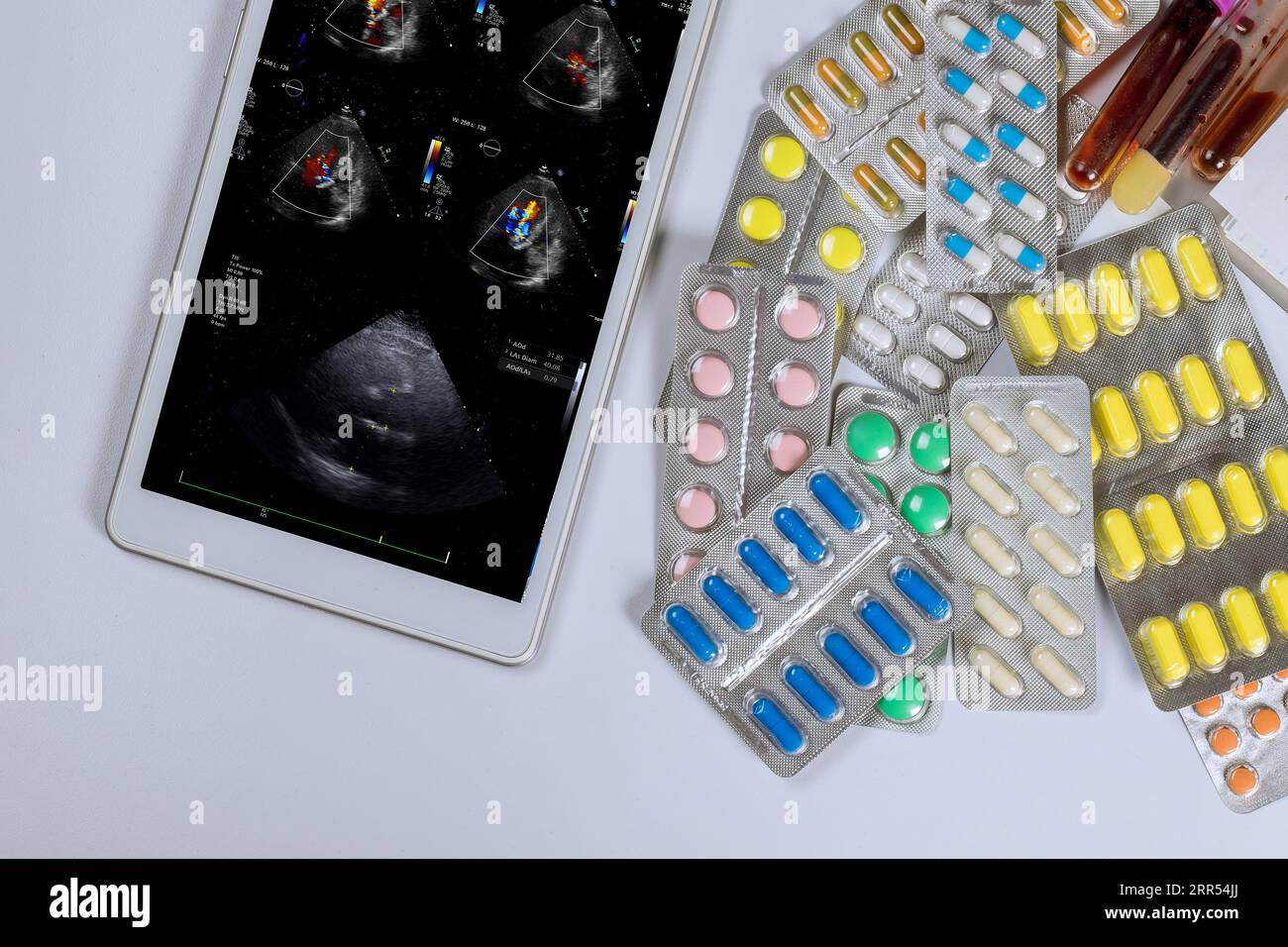 Using digital tablet doctor conducts echocardiography to assess patient ...