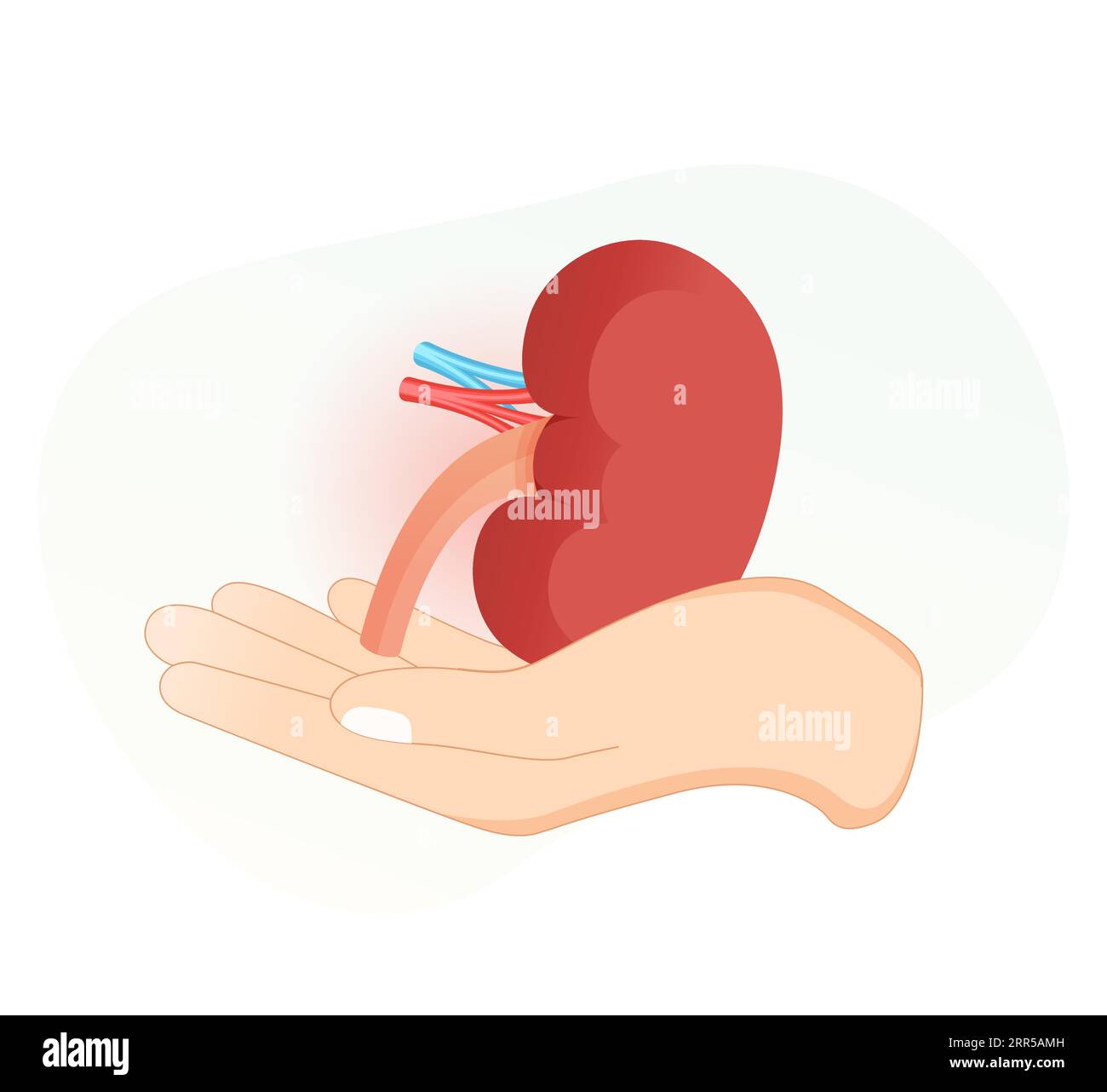 Hydronephrosis of the kidney hi-res stock photography and images - Alamy