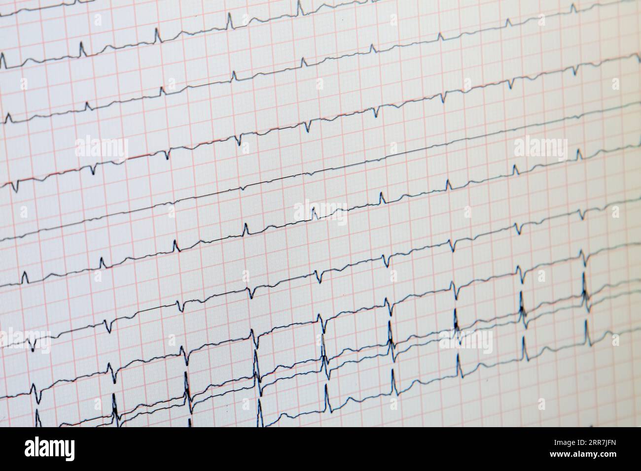 Electrocardiogram ecg hi-res stock photography and images - Alamy