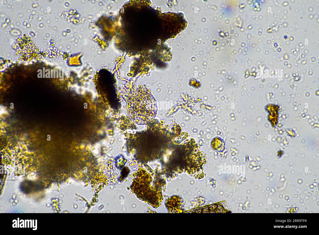 microbial organisms under the microscope in a lab in america Stock ...