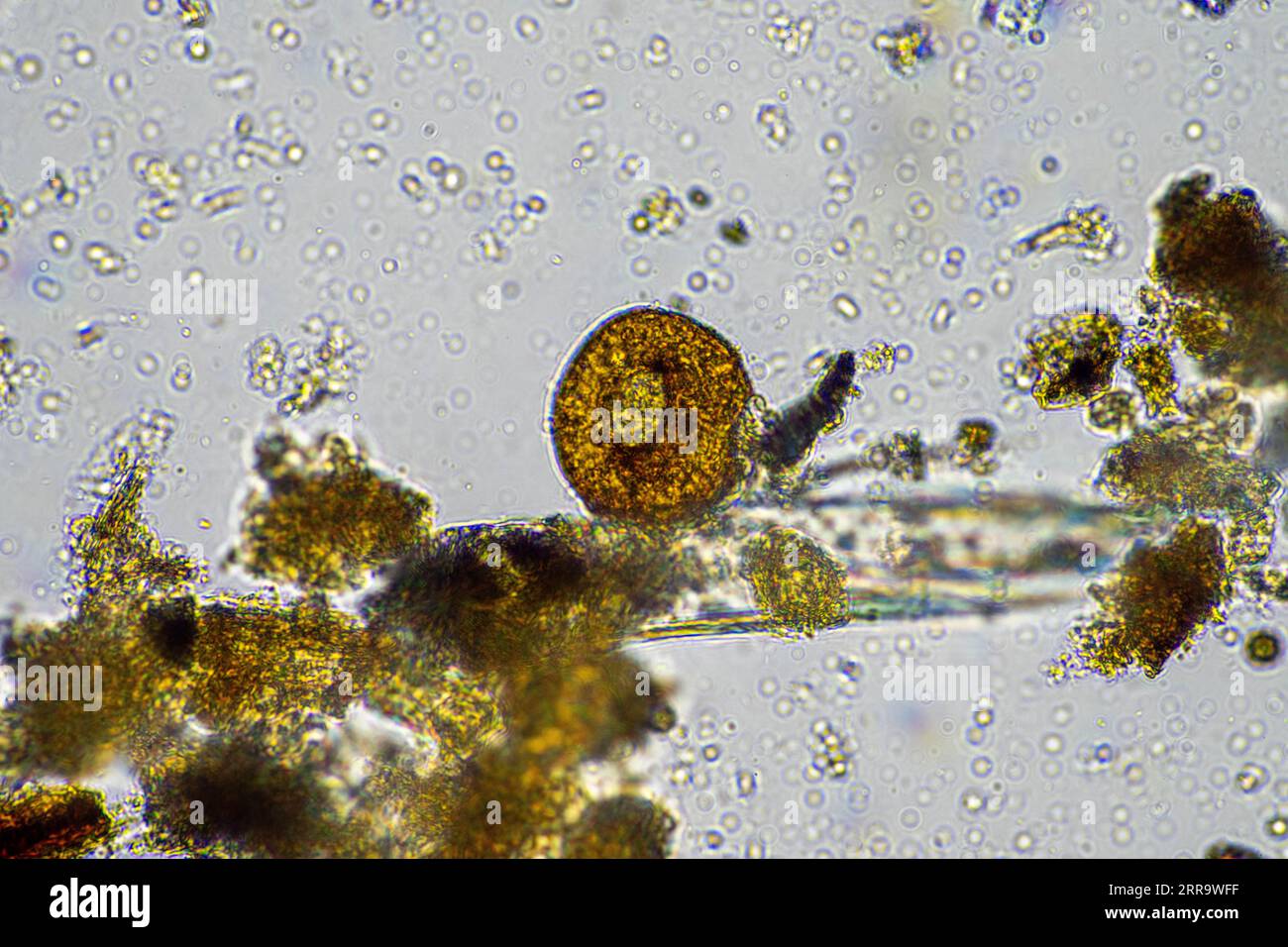 microbial organisms under the microscope in a lab in america Stock ...