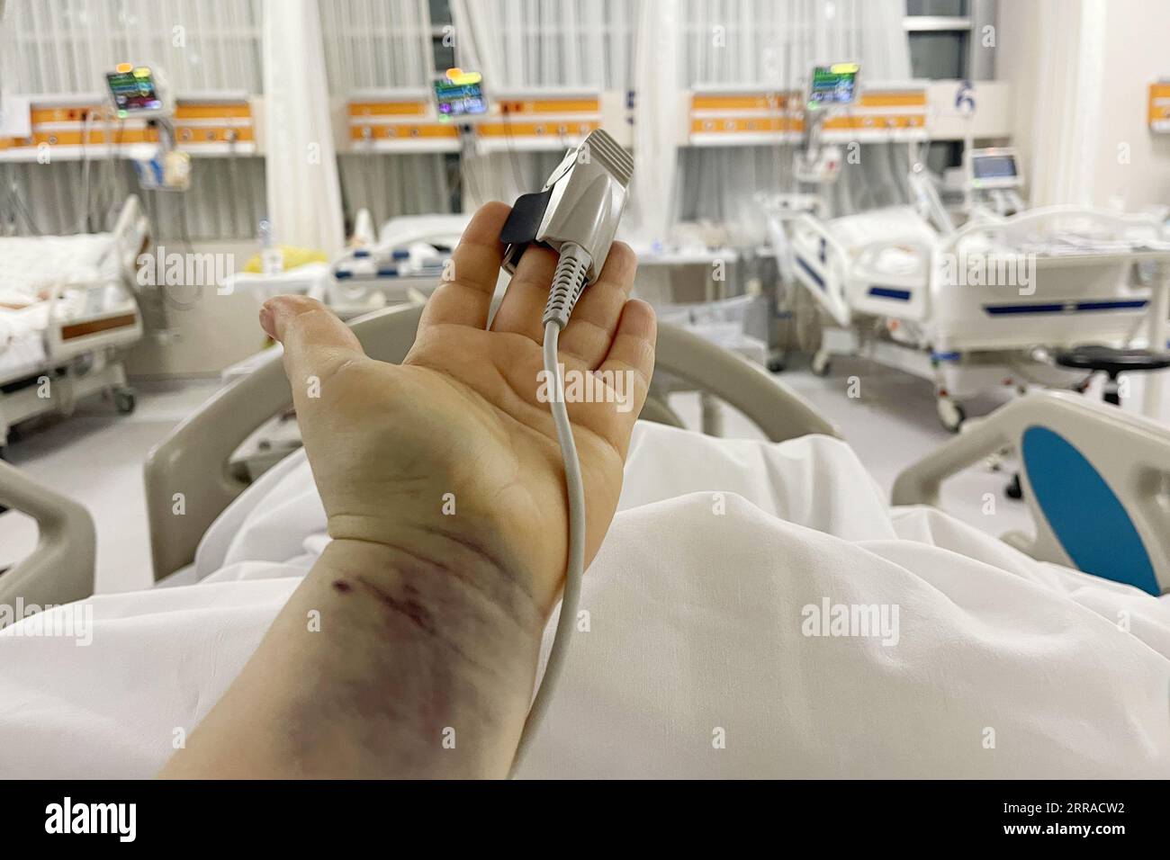 Vte treatment hi-res stock photography and images - Alamy