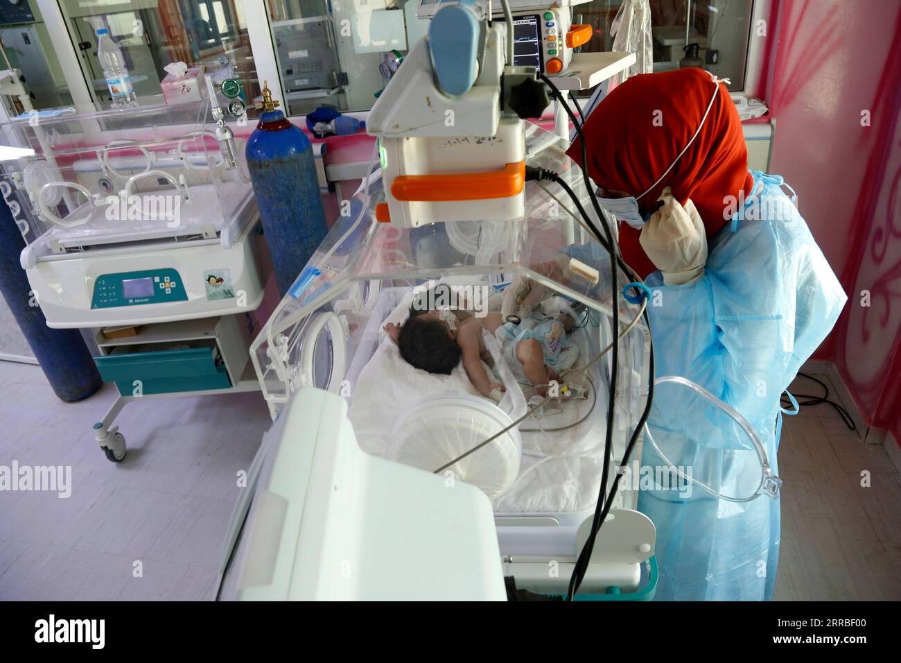 Conjoined twins born hi-res stock photography and images - Alamy