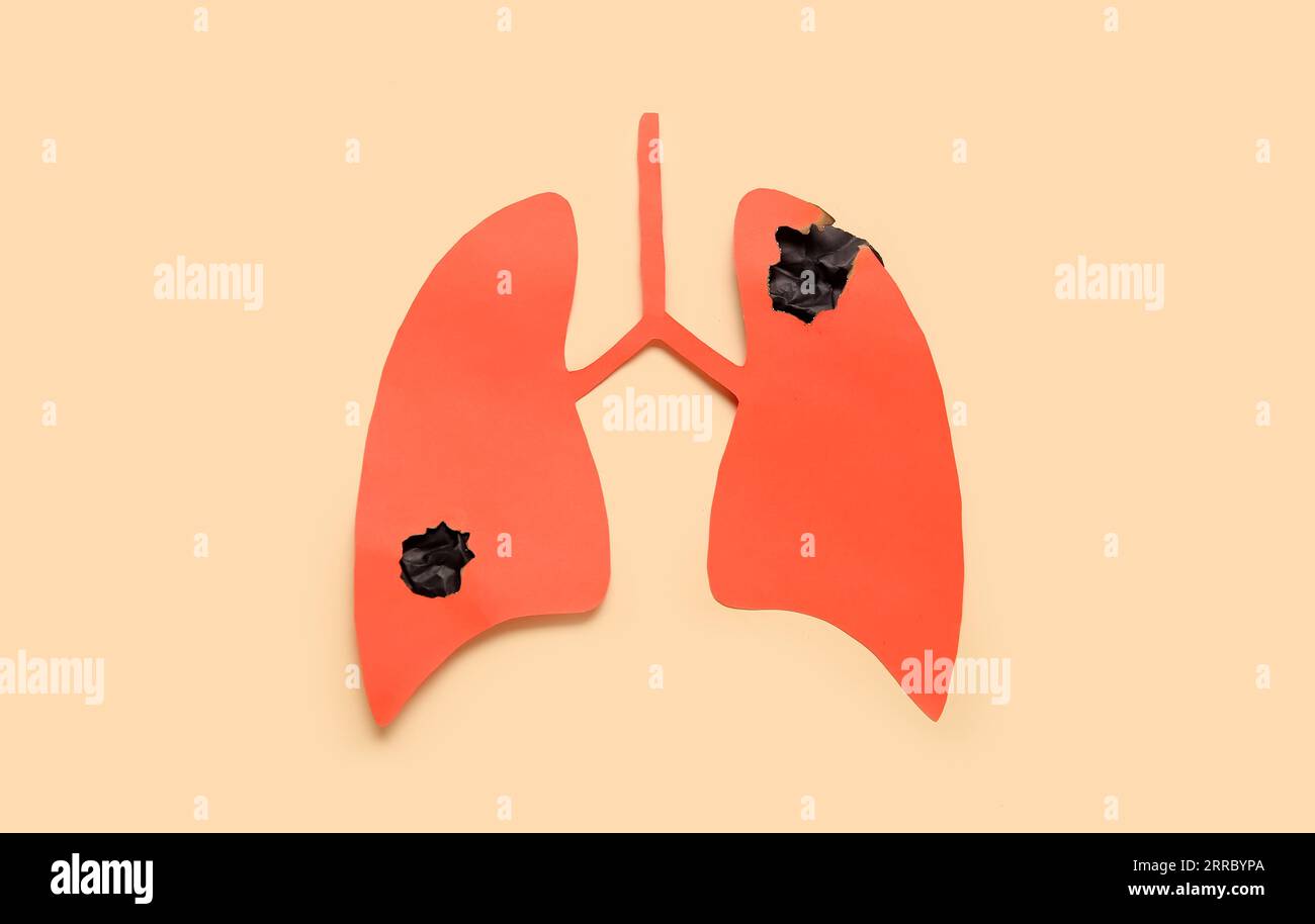 Paper lungs with tumors on beige background. Lung cancer concept Stock ...