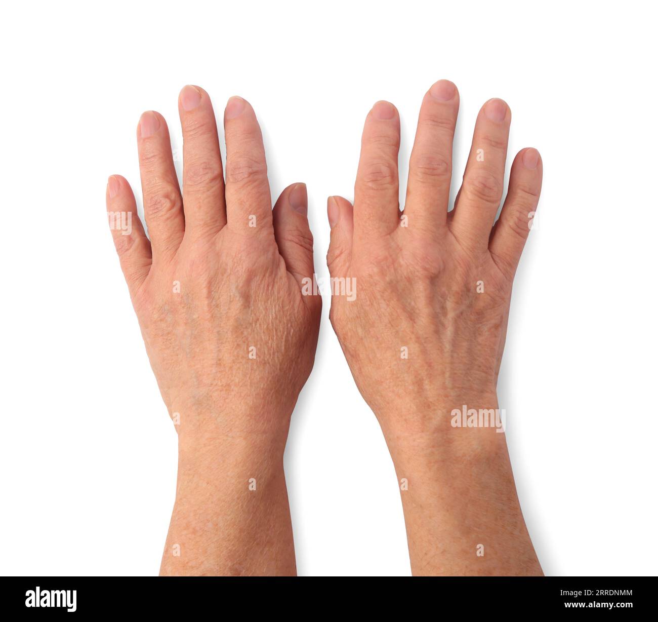 Closeup view of woman's hands with aging skin, top view Stock Photo - Alamy