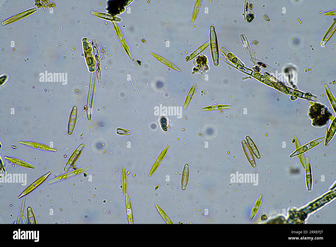 diatom and water microorganisms under the microscope in australia Stock ...