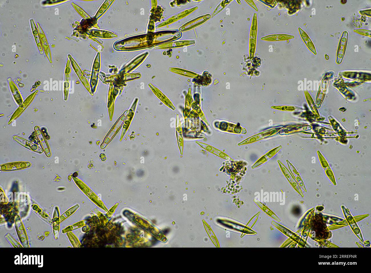 diatom and water microorganisms under the microscope in australia Stock ...