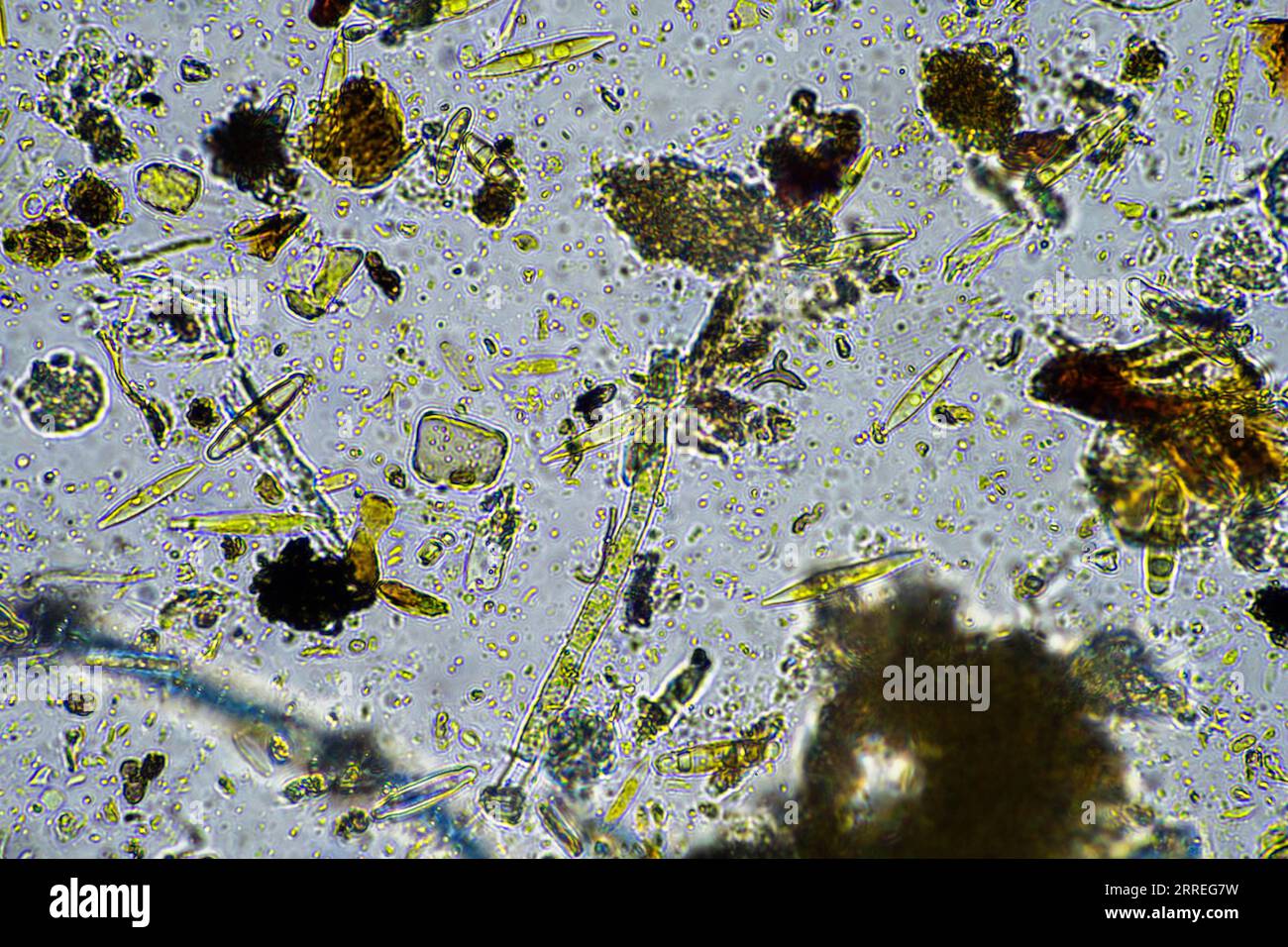 soil microorganisms close up under the microscope. in a soil samlple ...