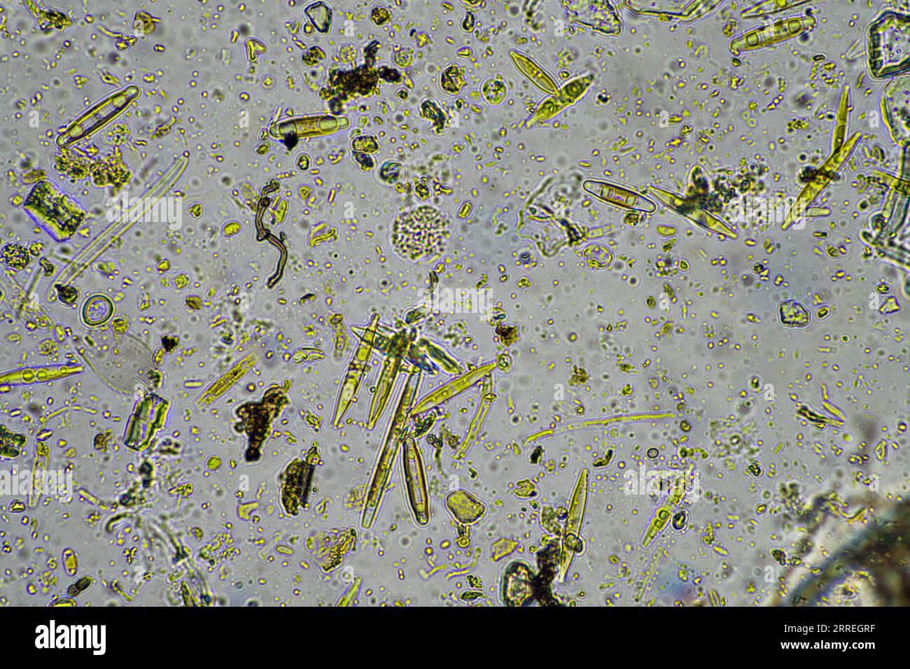 Soil nematode and fungi hi-res stock photography and images - Alamy