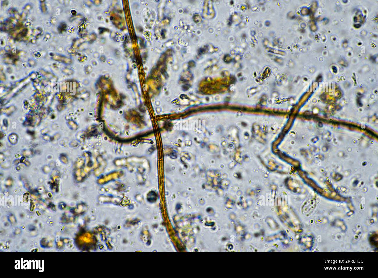 Fungal and fungi hyphae under the microscope in the soil and compost, in a soil biology and ...