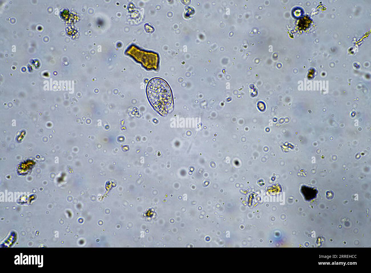 Fungal and fungi hyphae under the microscope in the soil and compost ...