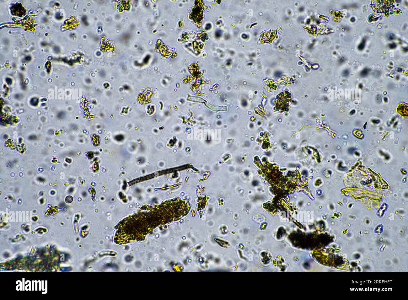 soil microorganisms close up under the microscope. in a soil samlple ...