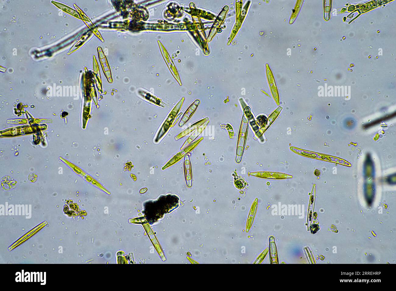 Diatoms Under Microscope Labeled