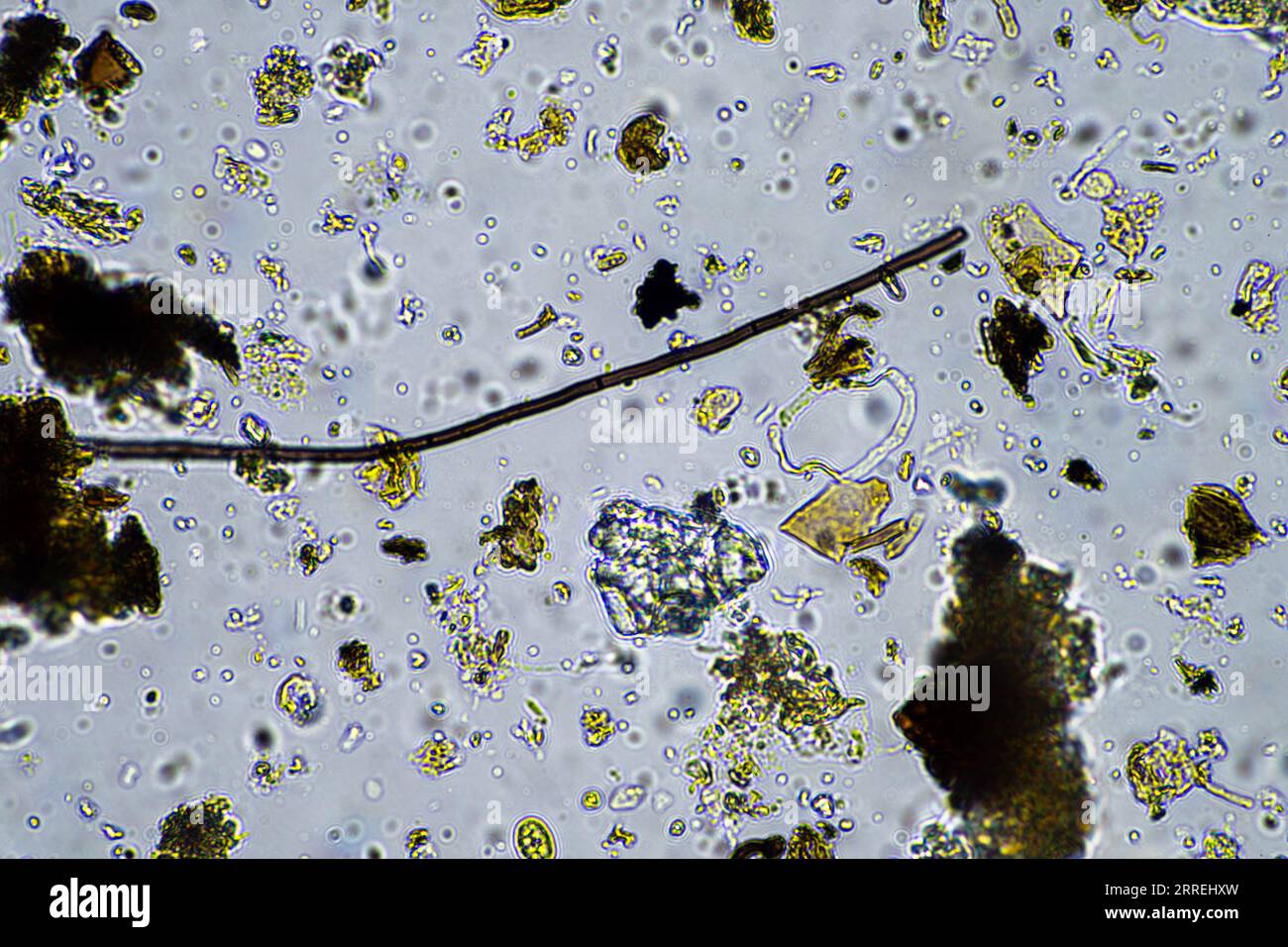 Fungal and fungi hyphae under the microscope in the soil and compost ...