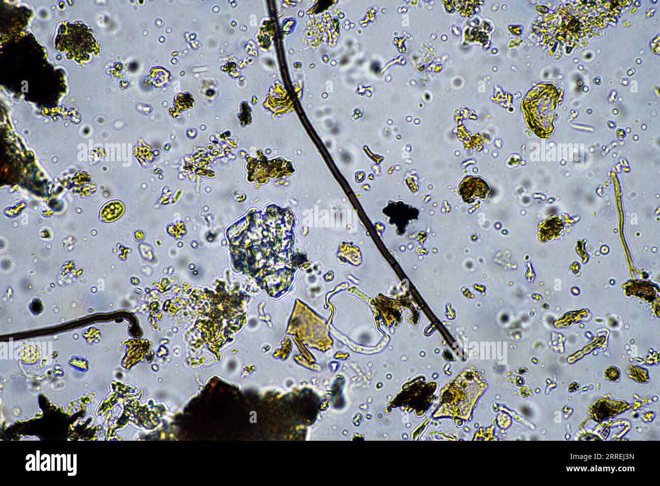 soil life under the microscope with soil fungi and fungal hyphae on a ...