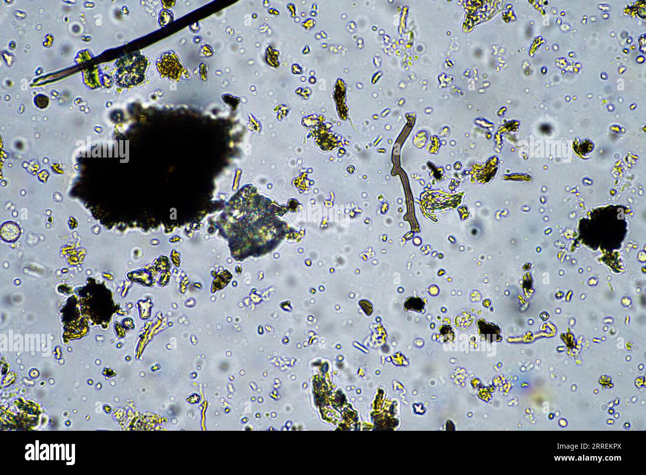 soil life under the microscope with soil fungi and fungal hyphae on a ...