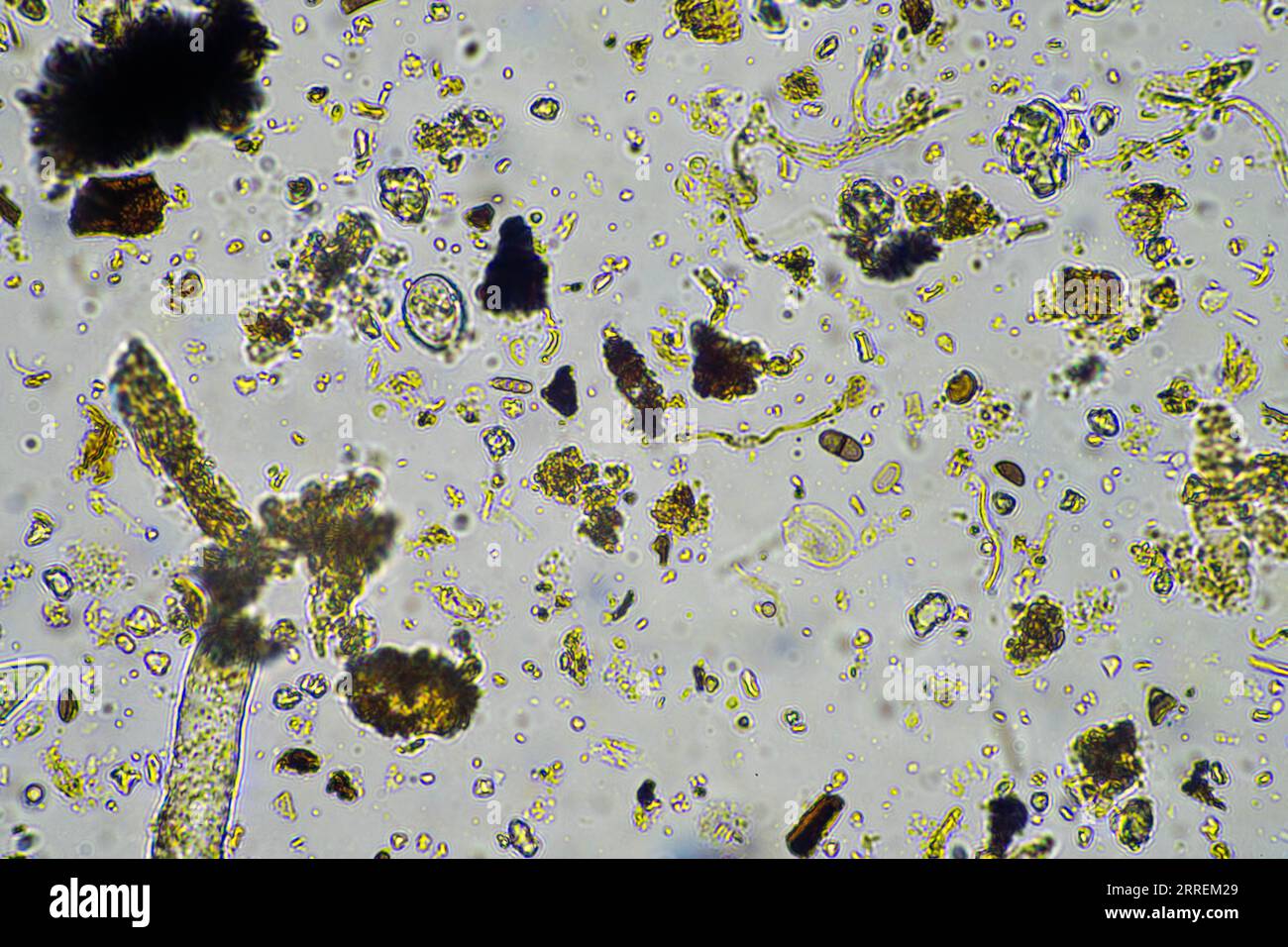 soil microorganisms close up under the microscope. in a soil samlple ...