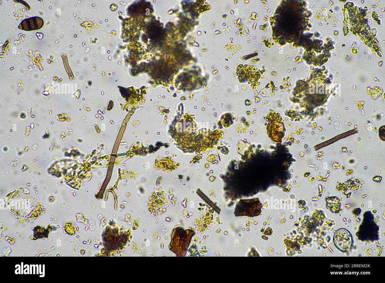 Polyporus Under A Microscope
