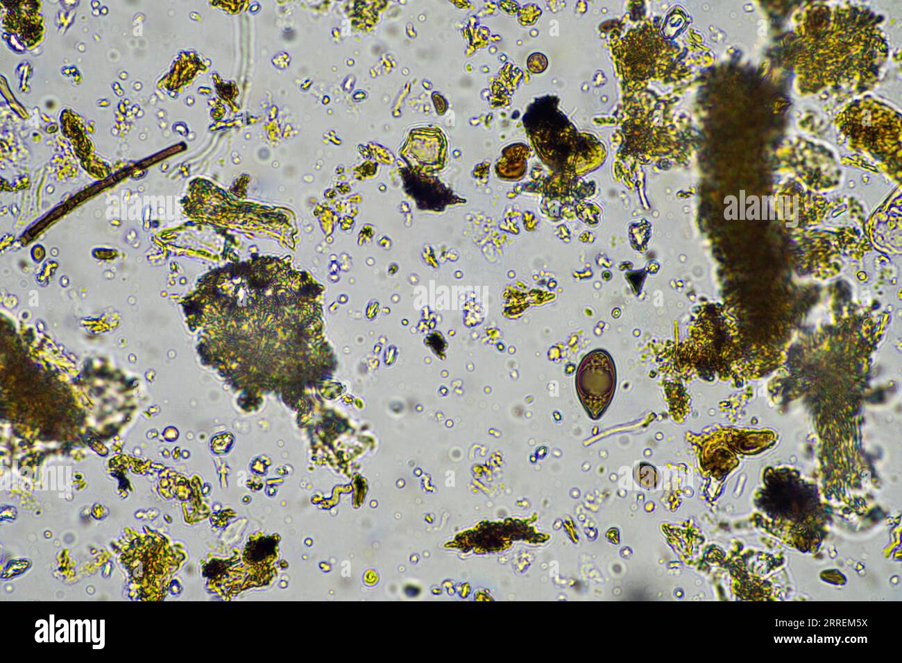 Fungal and fungi hyphae under the microscope in the soil and compost ...