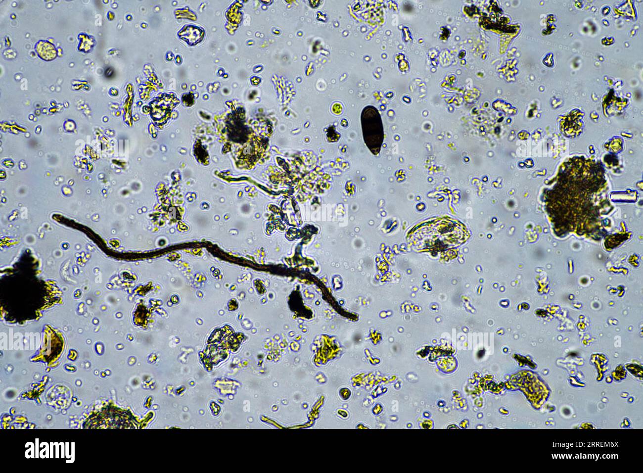 Fungal and fungi hyphae under the microscope in the soil and compost ...