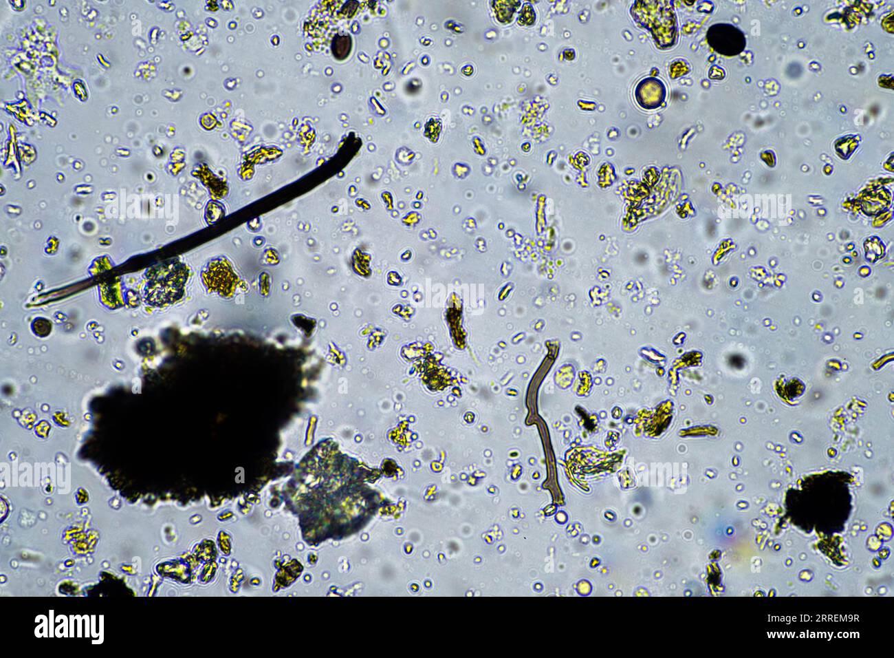 soil microorganisms close up under the microscope. in a soil samlple ...