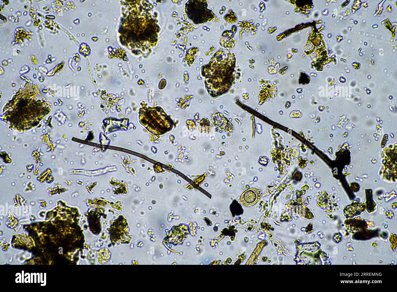 fungal hyphae and soil fungi in a soil sample, showing the living soil ...