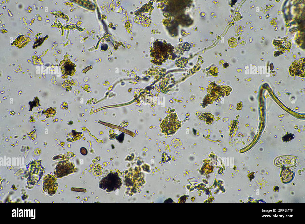 soil life under the microscope with soil fungi and fungal hyphae on a ...
