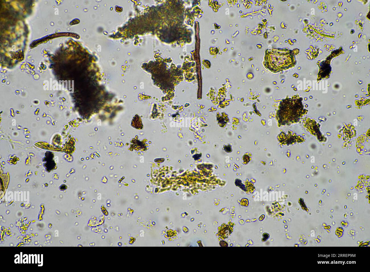 Fungal and fungi hyphae under the microscope in the soil and compost ...