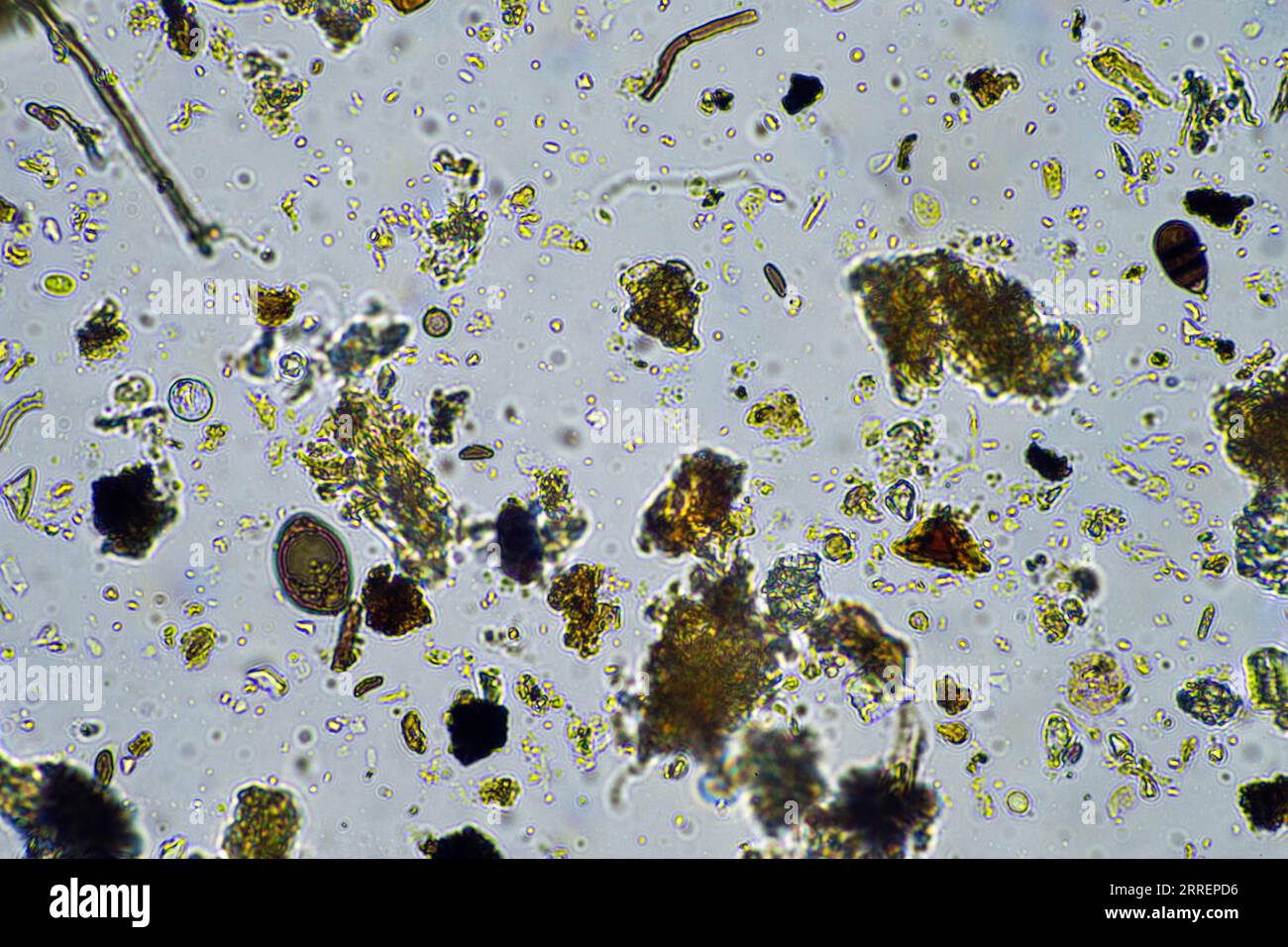 soil life under the microscope with soil fungi and fungal hyphae on a ...