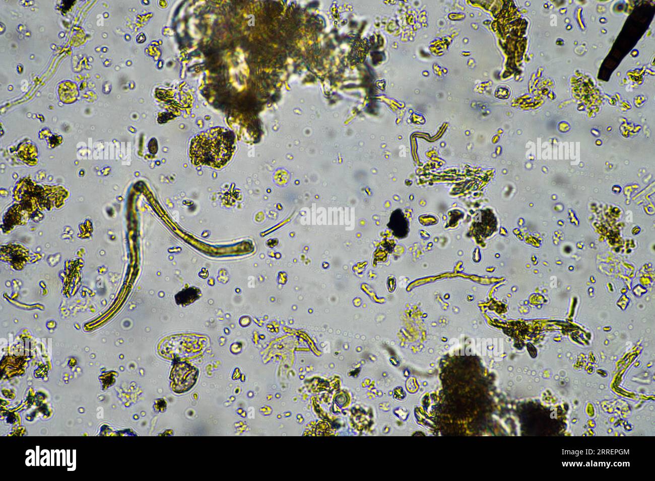 soil microorganisms close up under the microscope. in a soil samlple ...