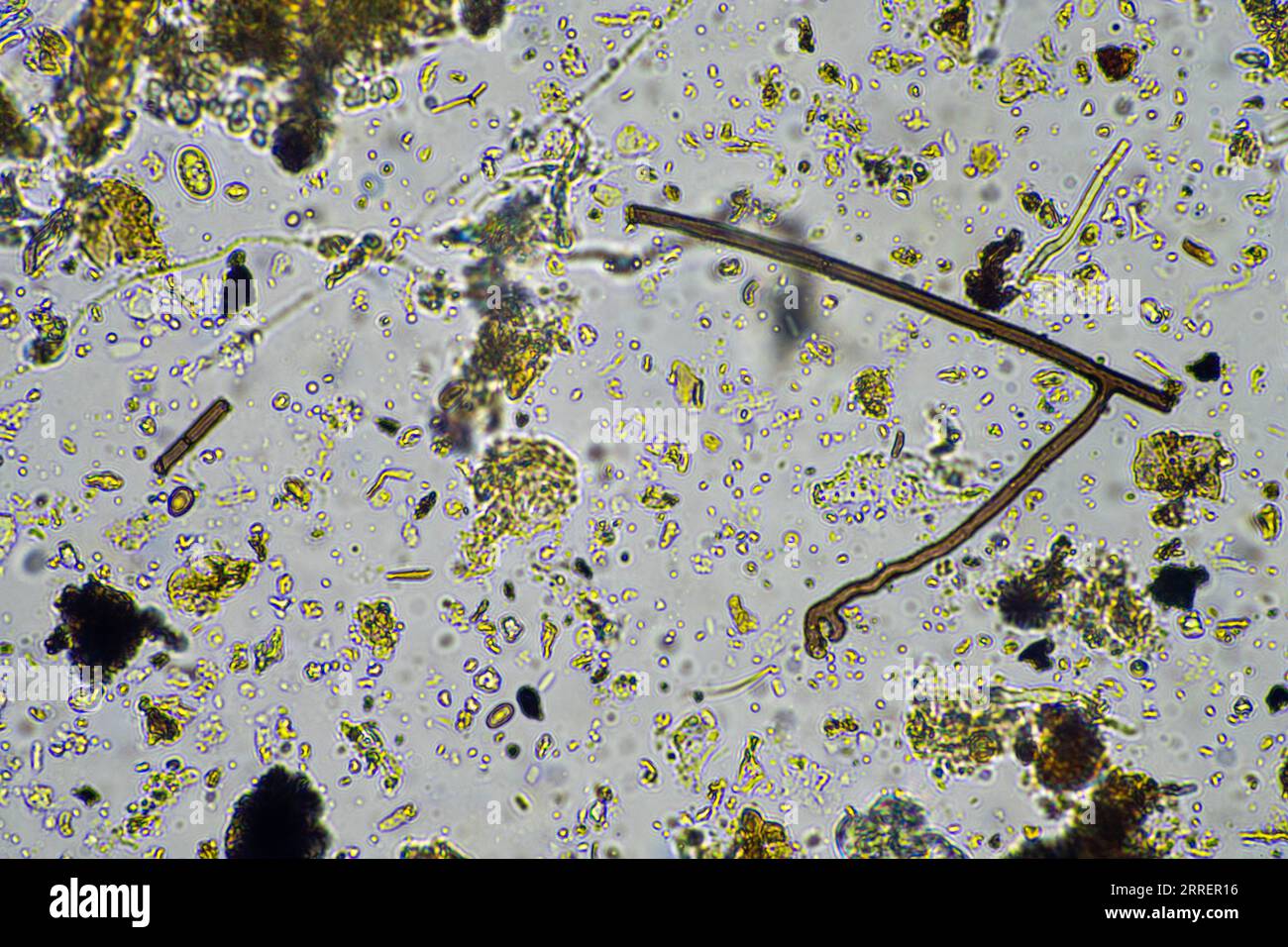 soil microorganisms close up under the microscope. in a soil samlple ...