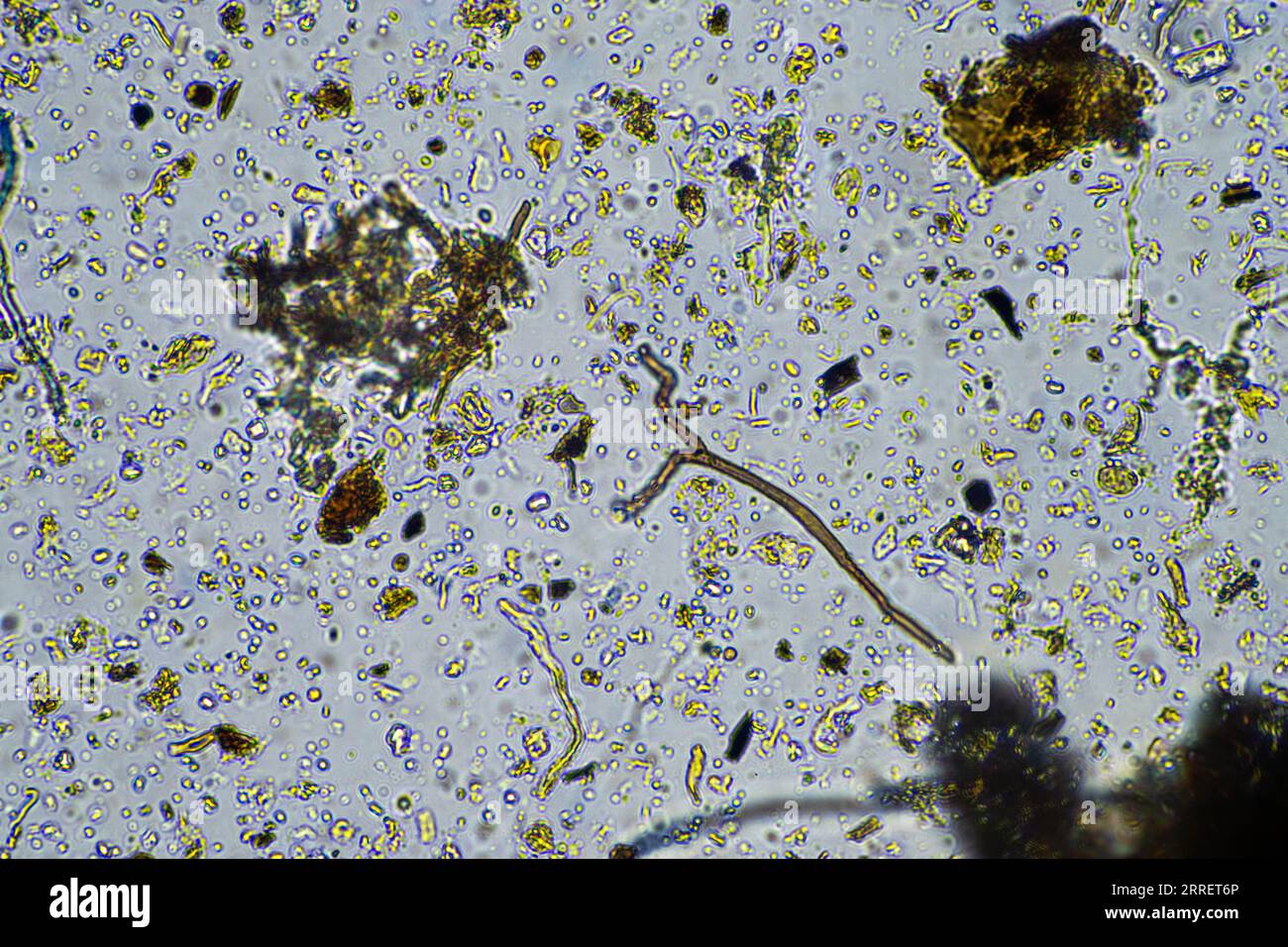Fungal and fungi hyphae under the microscope in the soil and compost ...