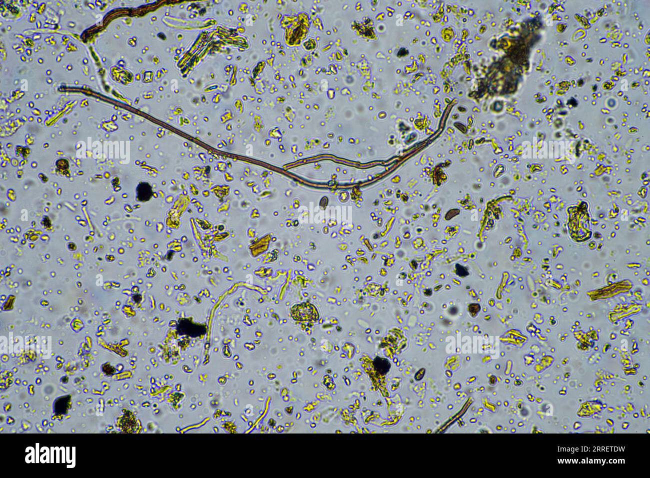 soil microorganisms close up under the microscope. in a soil samlple ...