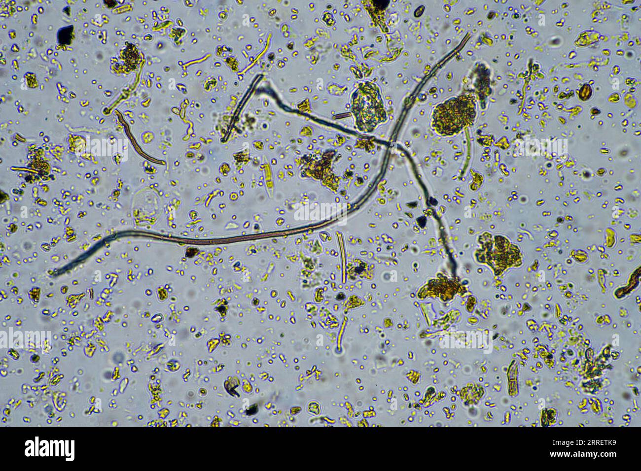 Fungal and fungi hyphae under the microscope in the soil and compost ...
