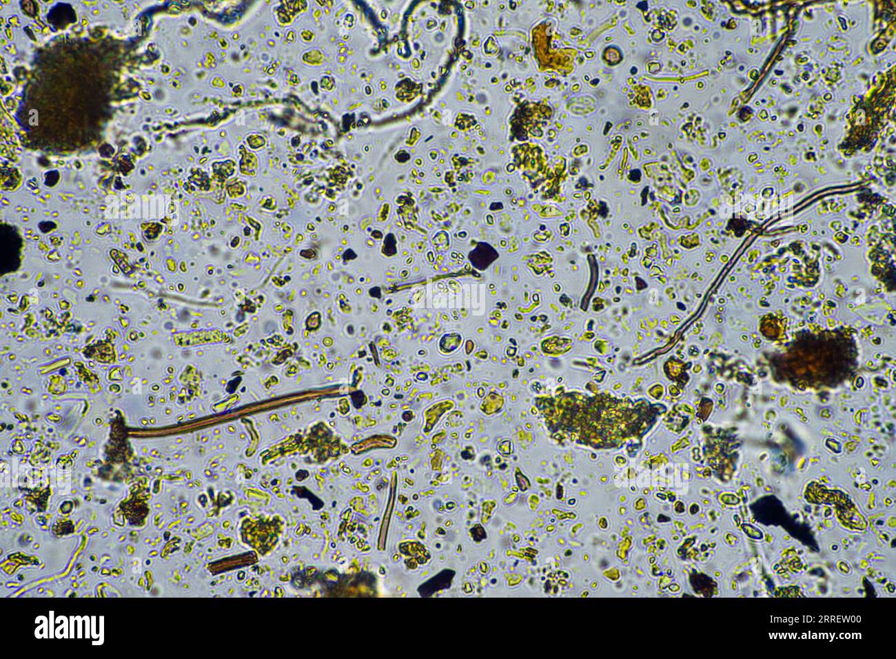 fungal hyphae and soil fungi in a soil sample, showing the living soil ...