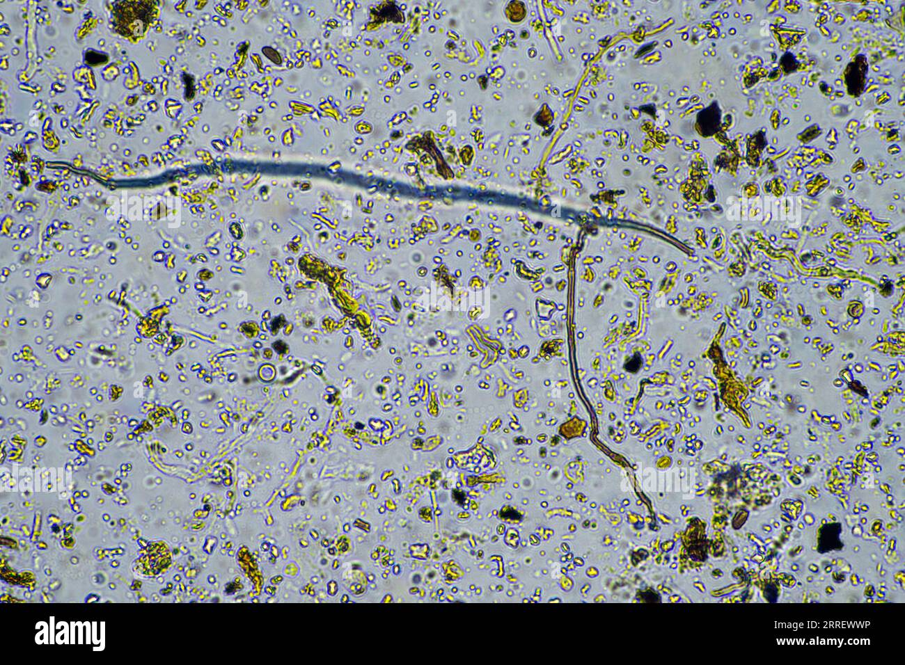 soil microorganisms close up under the microscope. in a soil samlple ...