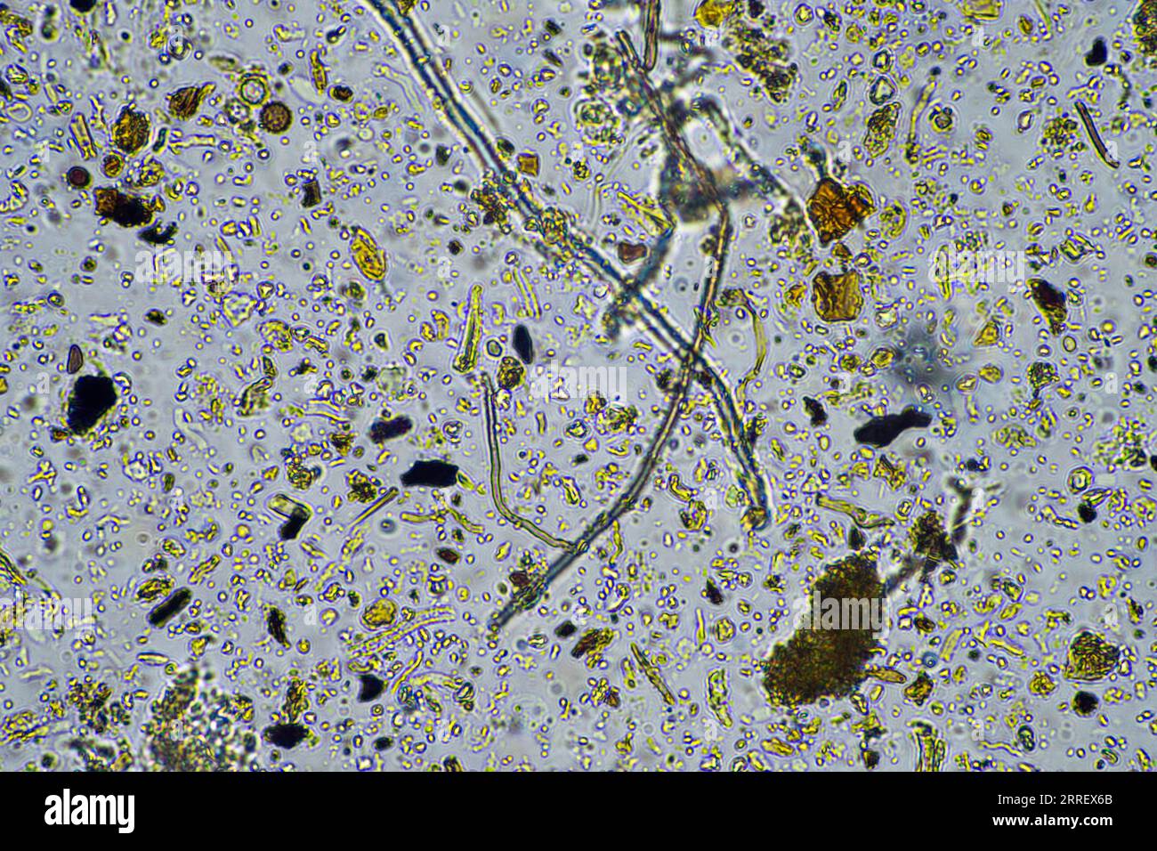 Fungal and fungi hyphae under the microscope in the soil and compost ...