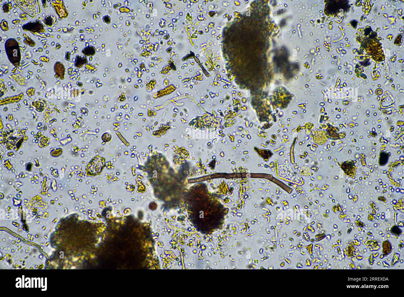 soil life under the microscope with soil fungi and fungal hyphae on a ...