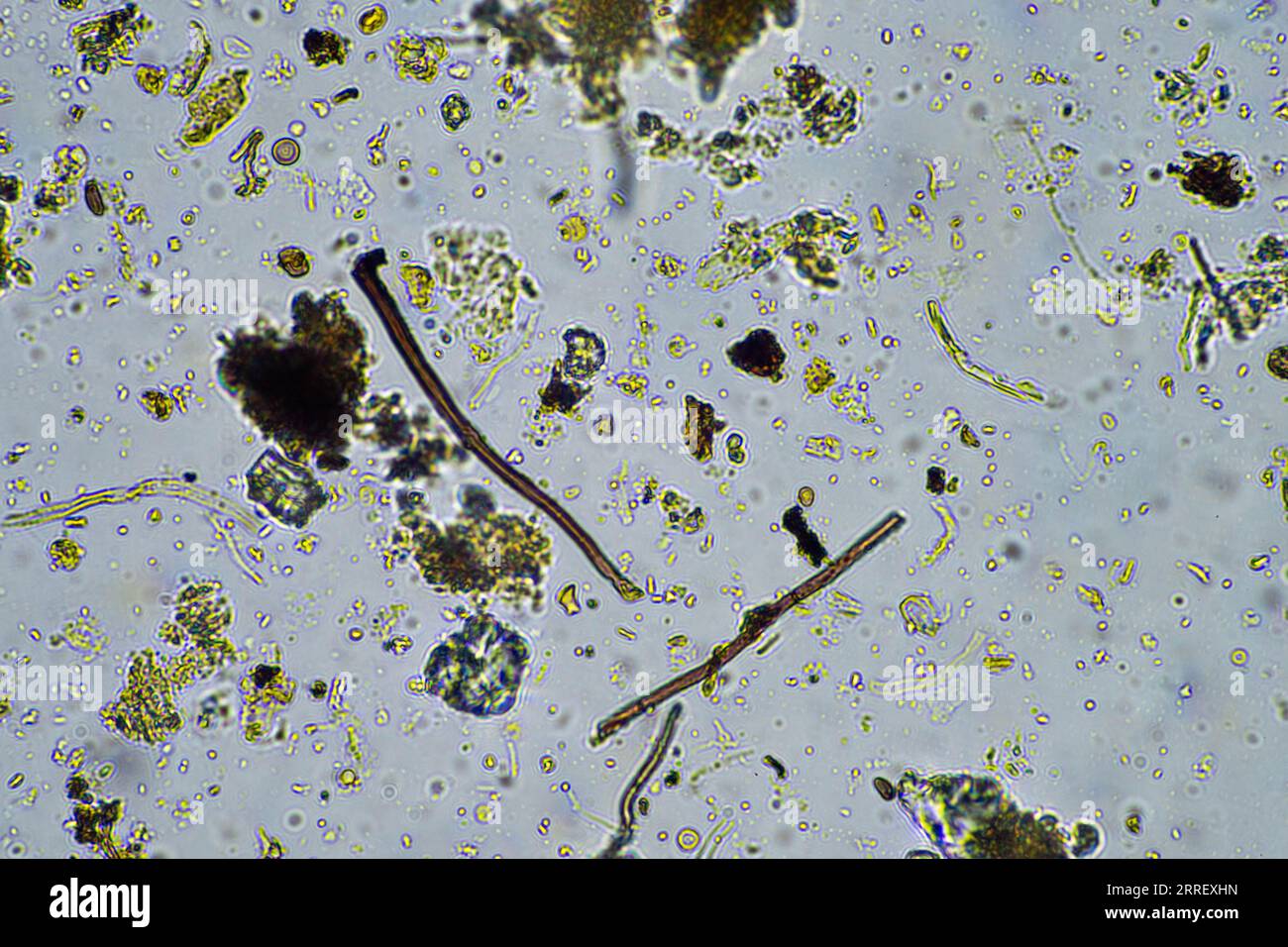soil life under the microscope with soil fungi and fungal hyphae on a ...