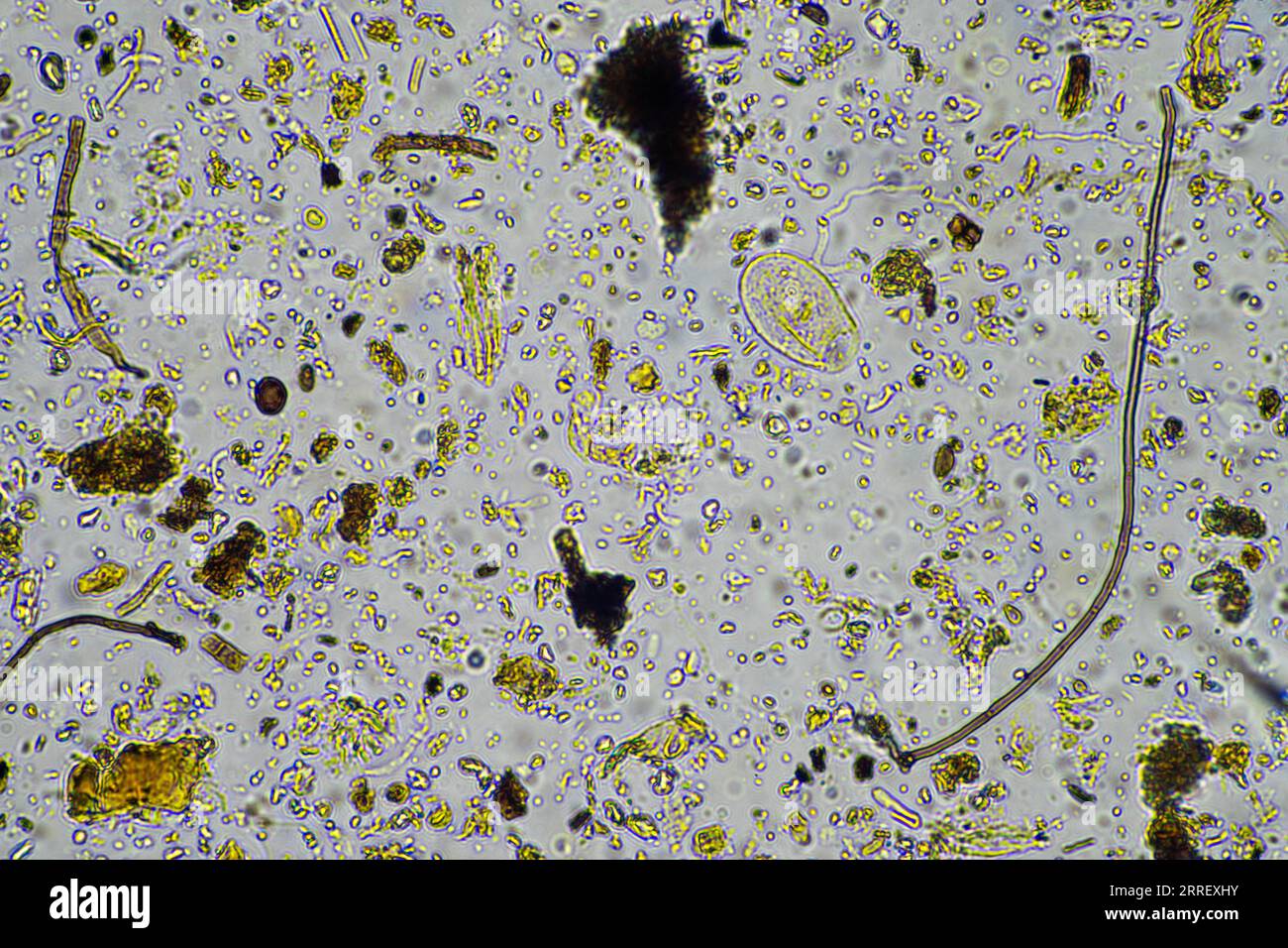 soil microorganisms close up under the microscope. in a soil samlple ...